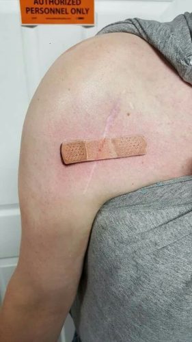 30 Scar Tattoo Ideas 2025 for Women and Men Cover Up Surgical Scars ...
