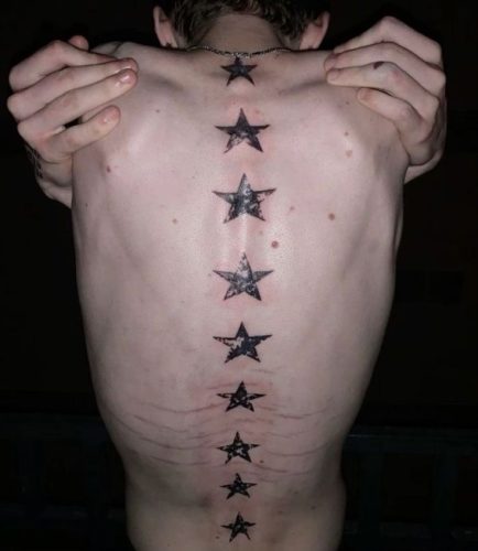 30 Scar Tattoo Ideas 2025 for Women and Men Cover Up Surgical Scars ...